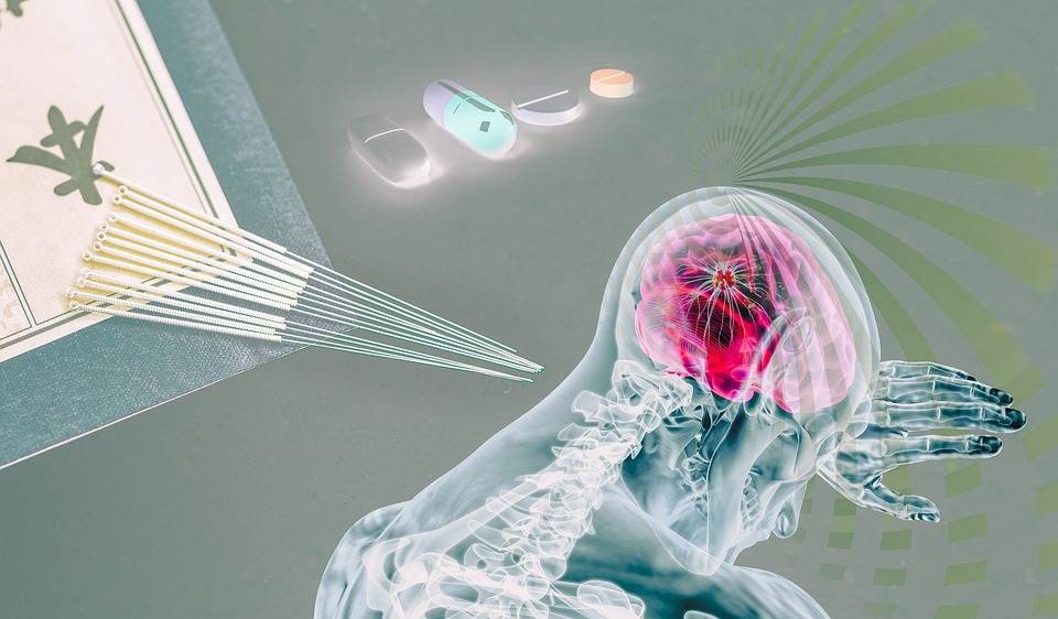 Acupuncture Photos | Free Stock Images | Everypixel